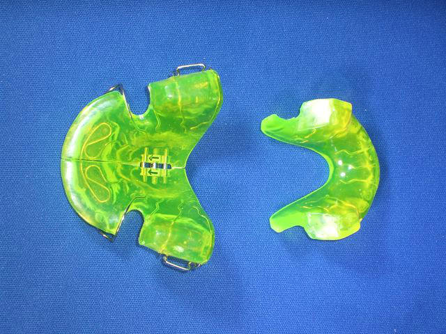 Gewone beugels - Beugels - Behandeling - Orthodontiepraktijk Harderwijk ...